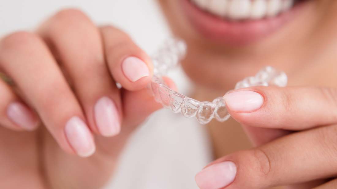 Ultimate Guide to Clear Aligners: Part 1 | SureSmile® Clear Aligners